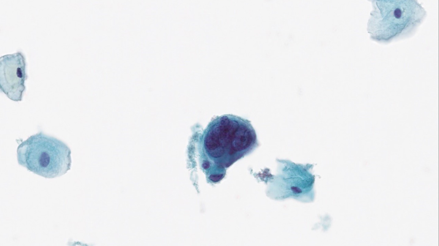Slide Box - Cytology GYN 1 | Pathology Residency | Medical School ...