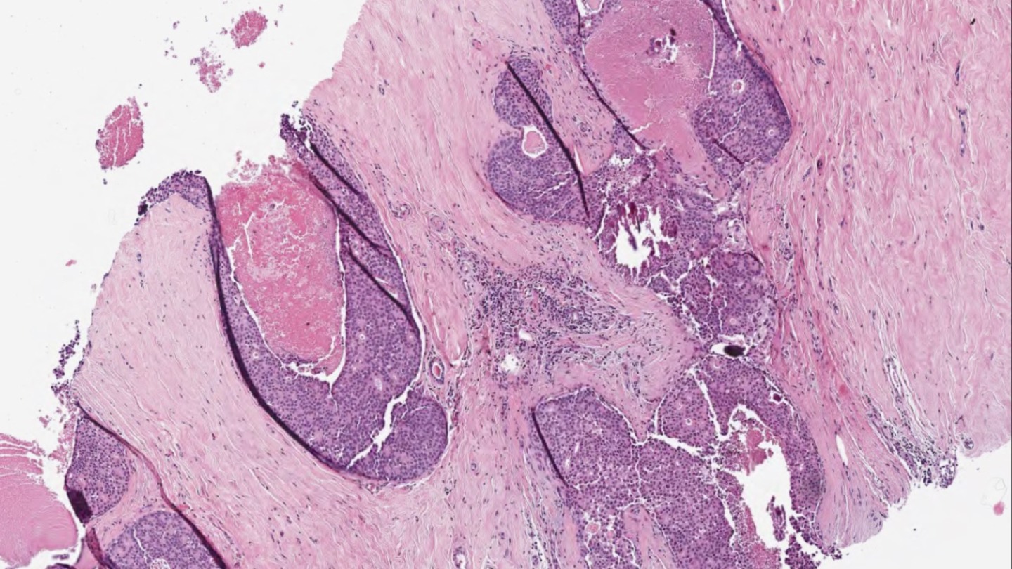 Slide Box - Breast 1 | Pathology Residency | Medical School | Brown ...